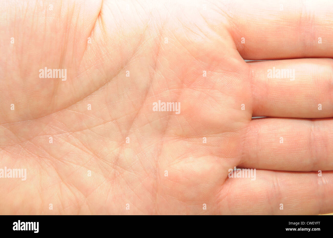 Detail of human palm suitable as background Stock Photo - Alamy