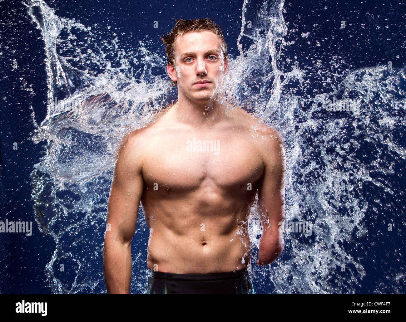 Congenital Water High Resolution Stock Photography and Images - Alamy