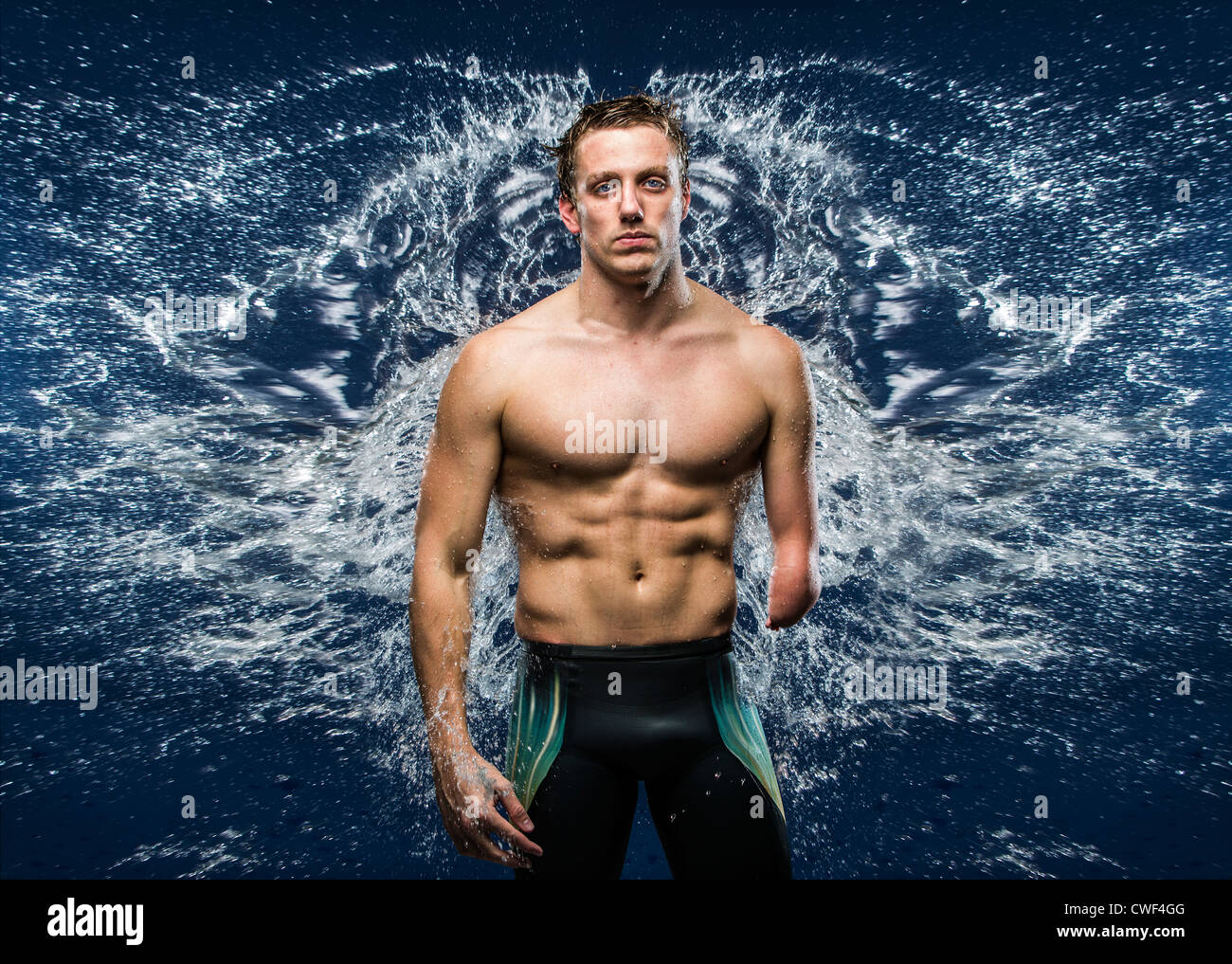 Congenital Water High Resolution Stock Photography and Images - Alamy