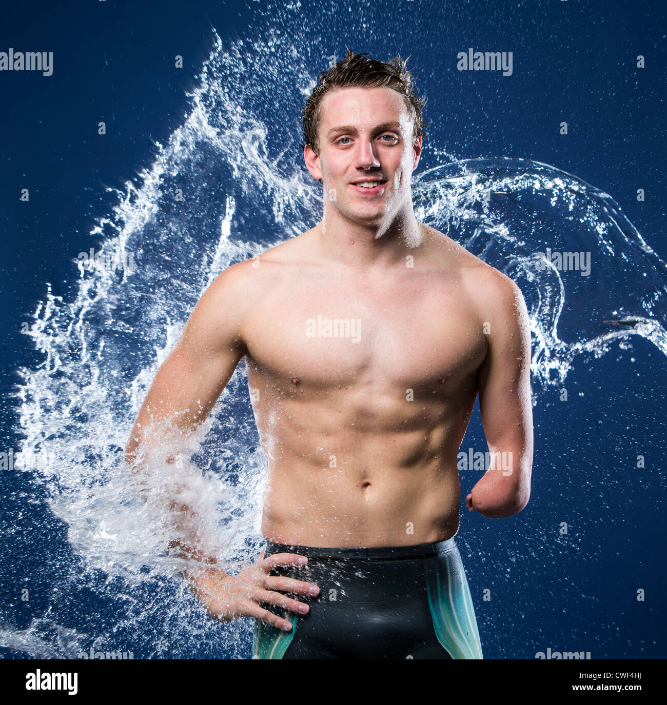 Congenital Water High Resolution Stock Photography and Images - Alamy