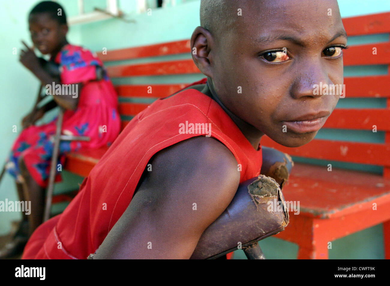 Polio disabled girl hi-res stock photography and images - Alamy