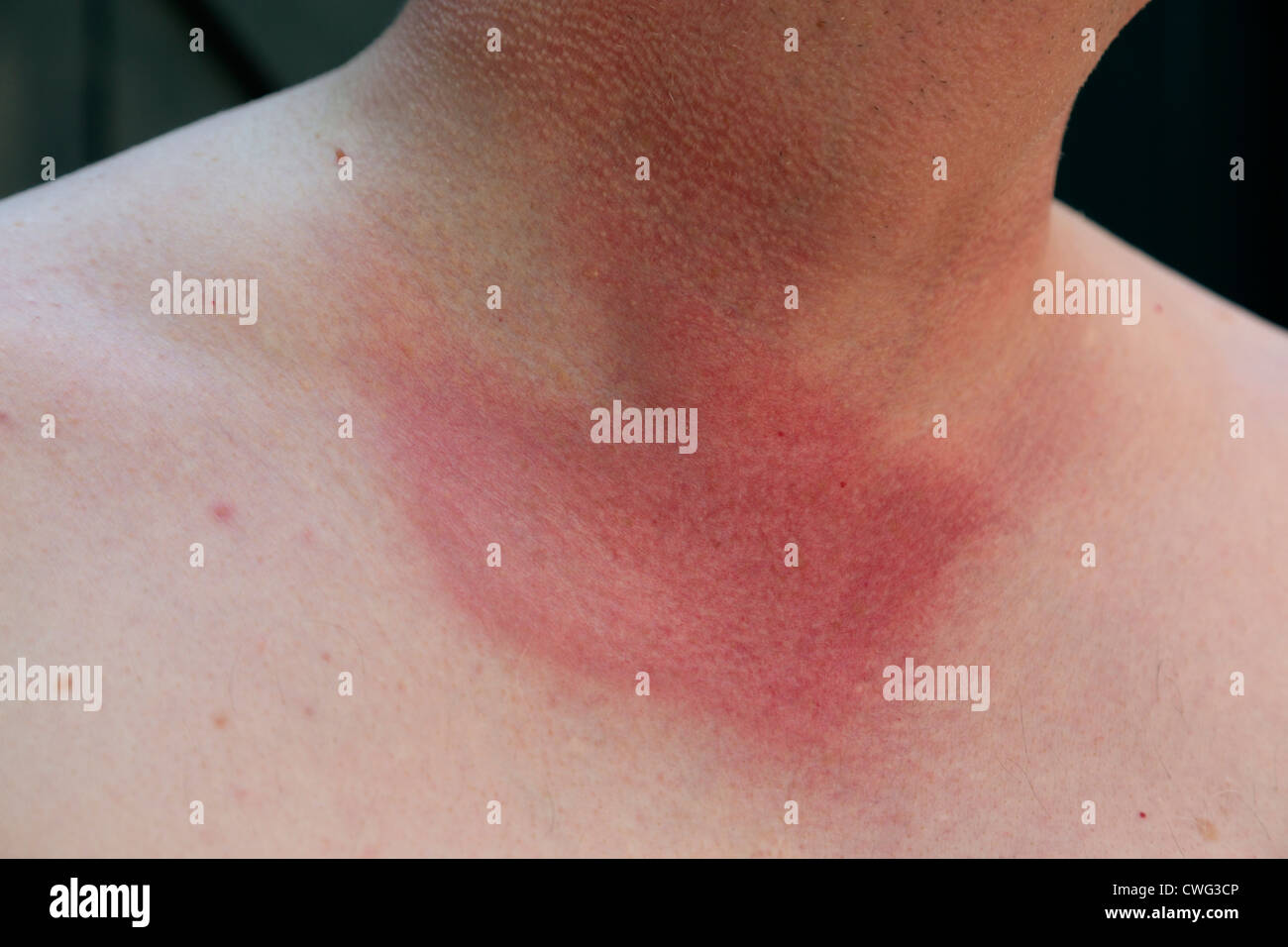 Pale skin man hi-res stock photography and images - Alamy