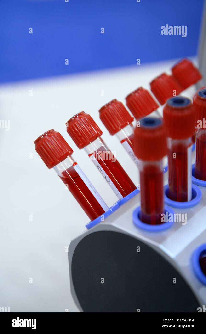 Blood Sedimentation High Resolution Stock Photography and Images - Alamy