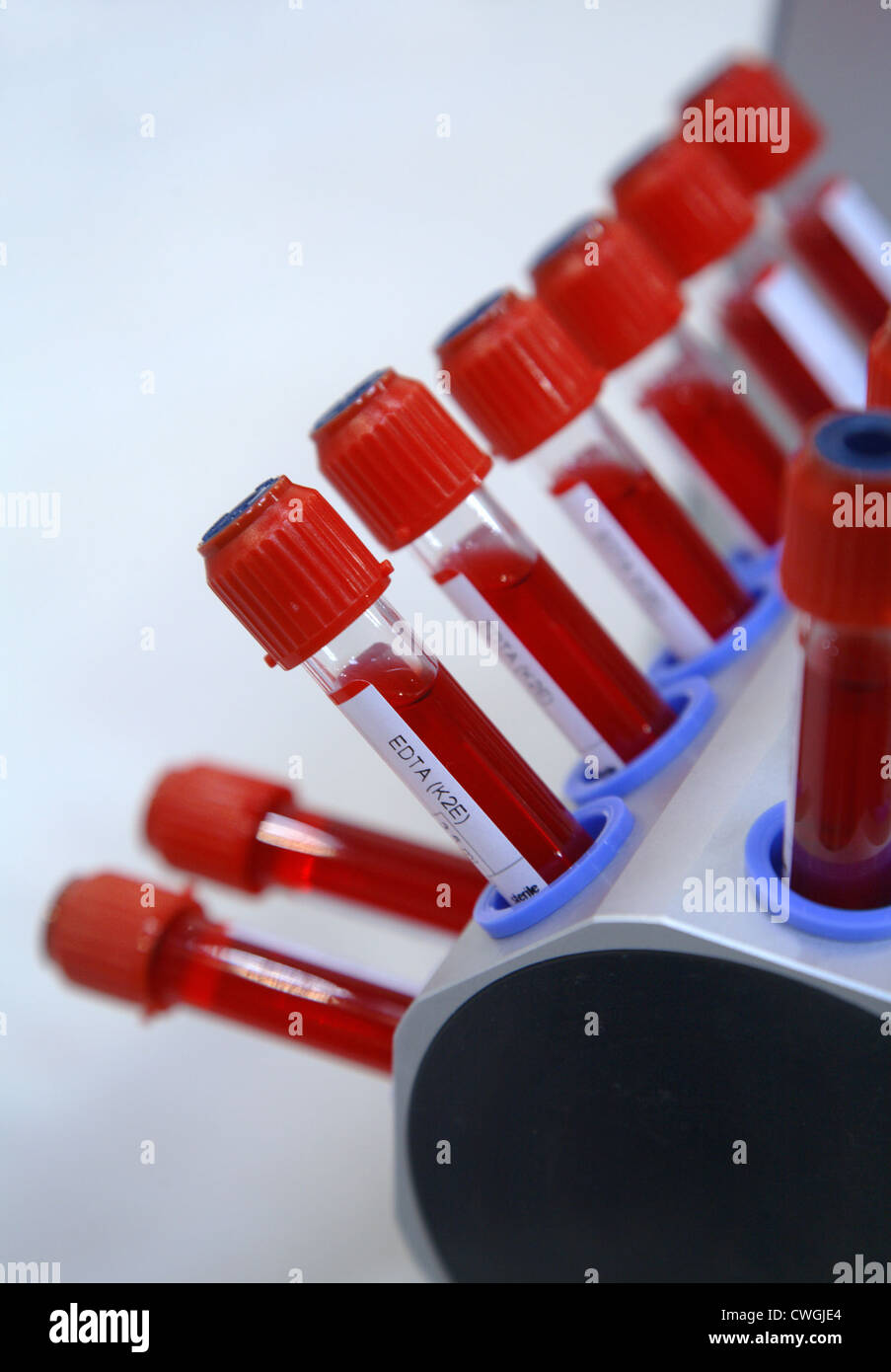 Blood sedimentation hi-res stock photography and images - Alamy