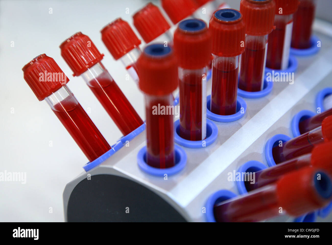 Sedimentation sample hi-res stock photography and images - Alamy