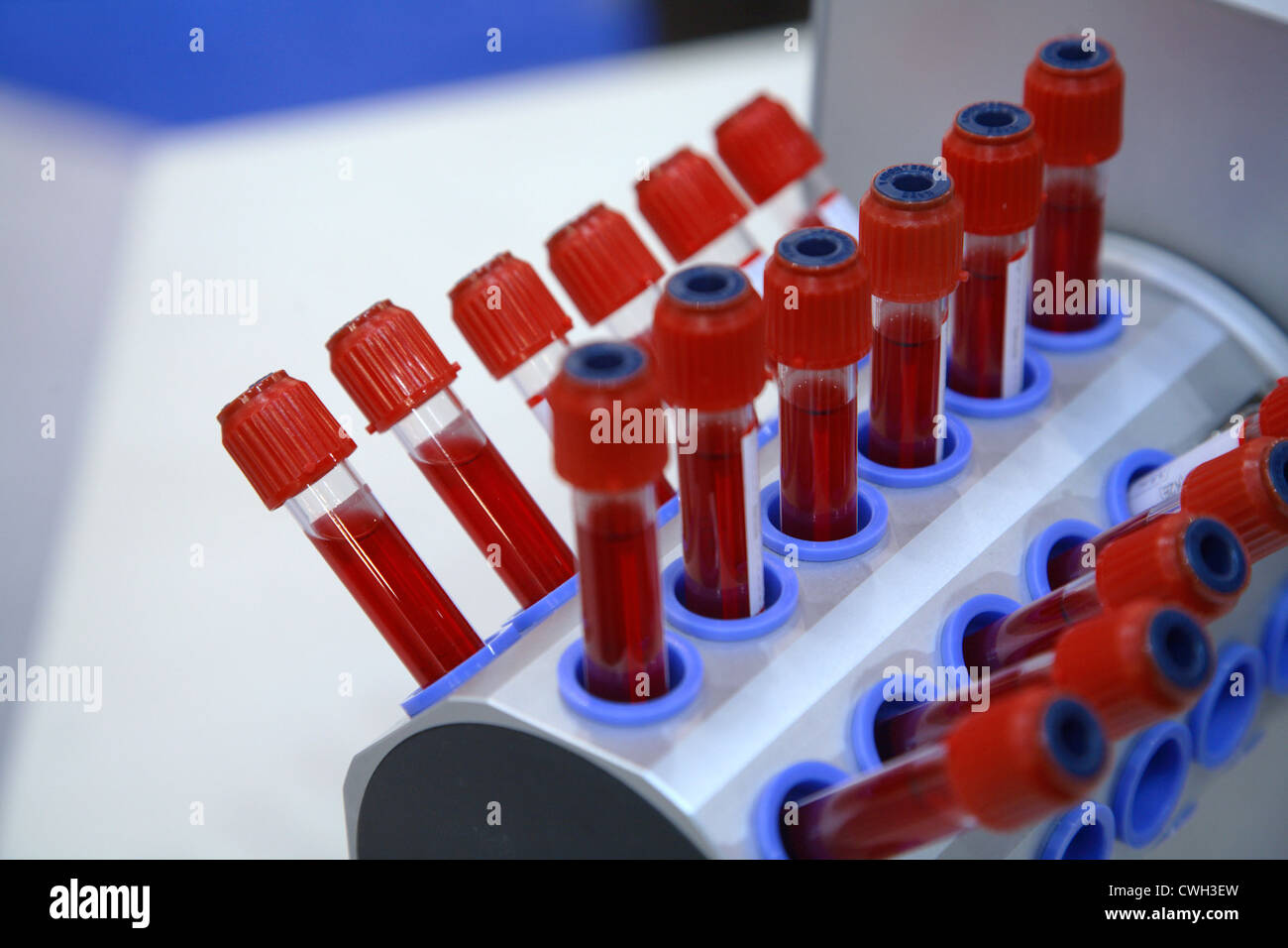 Citrated blood hi-res stock photography and images - Alamy