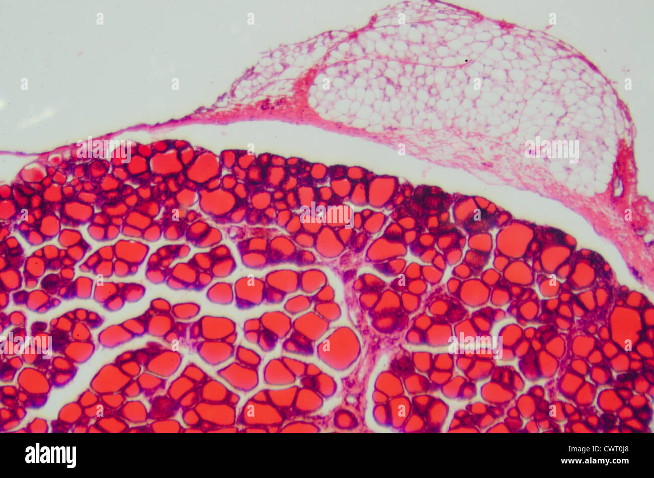 science medical anthropotomy physiology microscopic section of thyroid ...