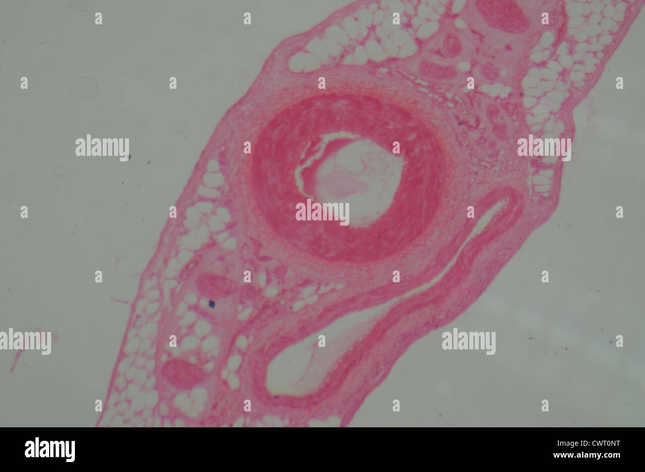science medical anthropotomy physiology microscopic section artery vein ...