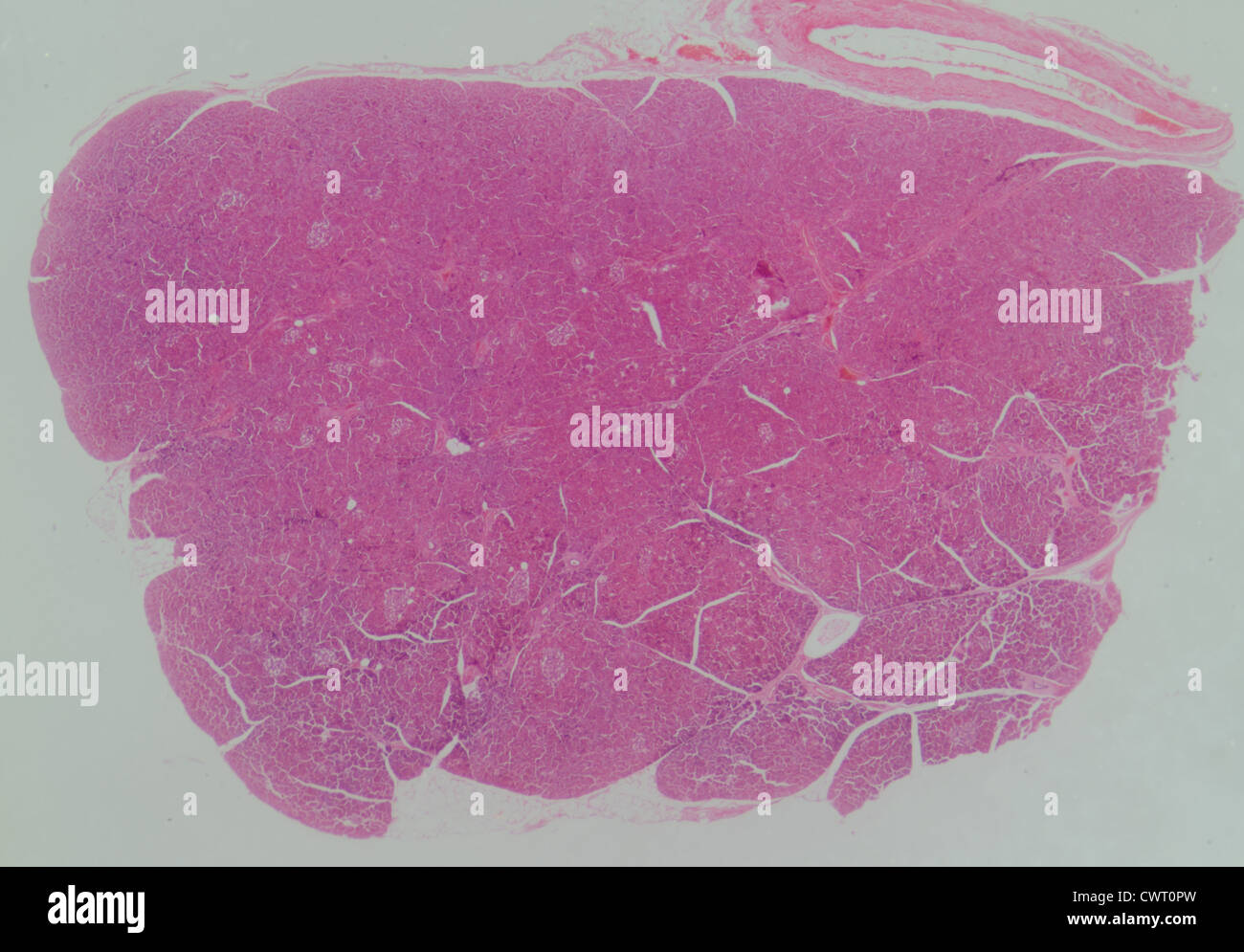 Section of human pancreas hi-res stock photography and images - Alamy