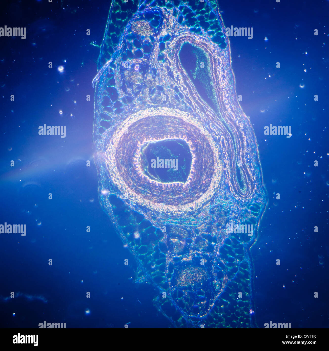 Micrograph of blood vessel hi-res stock photography and images - Alamy