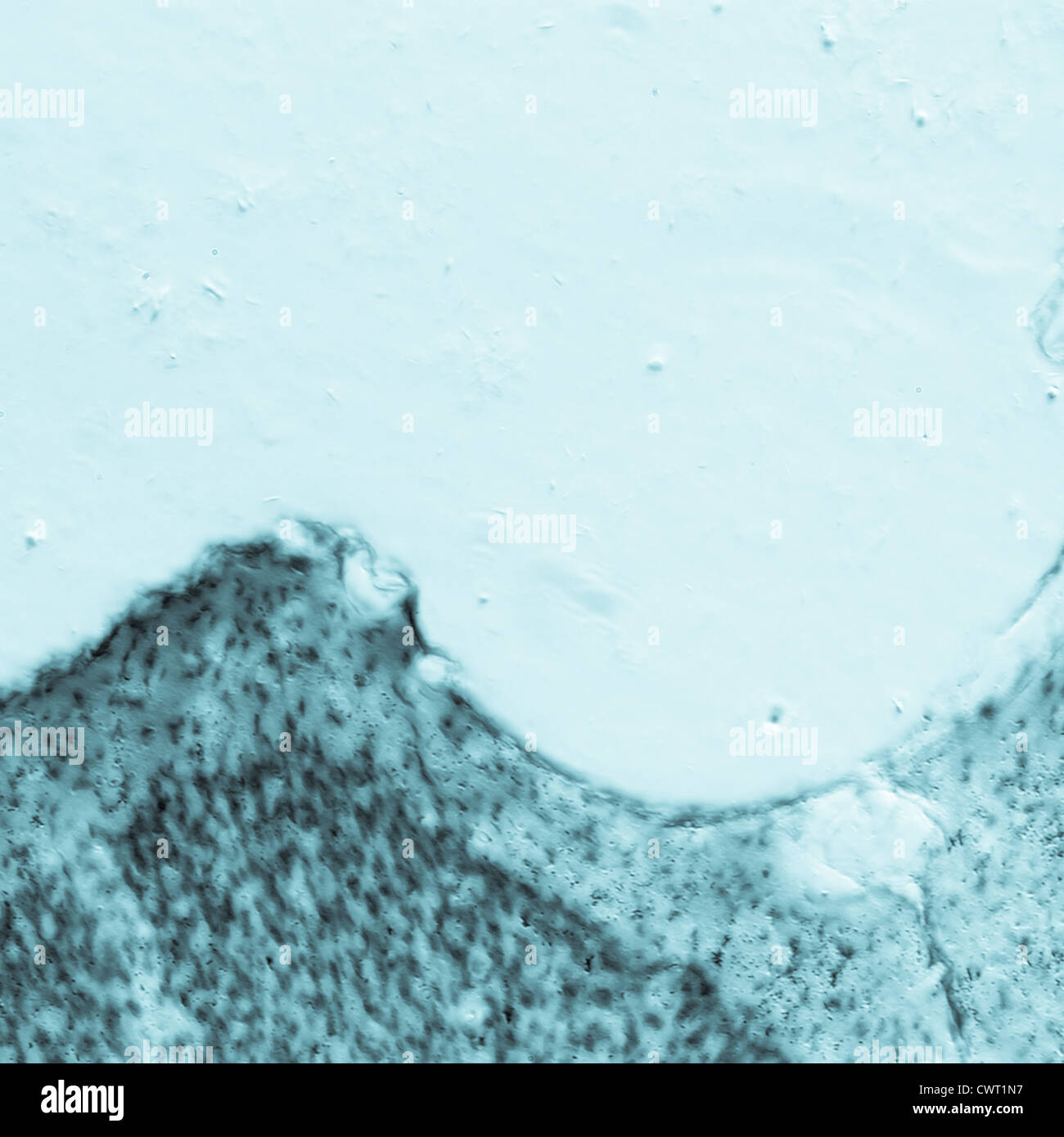 science medical microscopy micrograph, rat brain hippocampal neurons ...