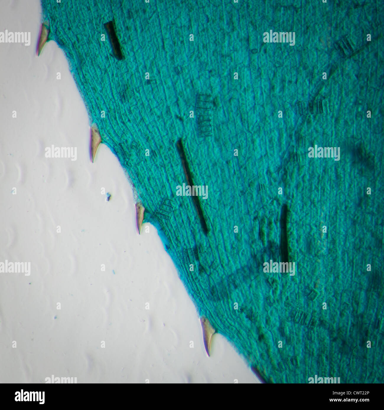 science microscopy micrograph black algae leaf Hydrilla verticillata ...