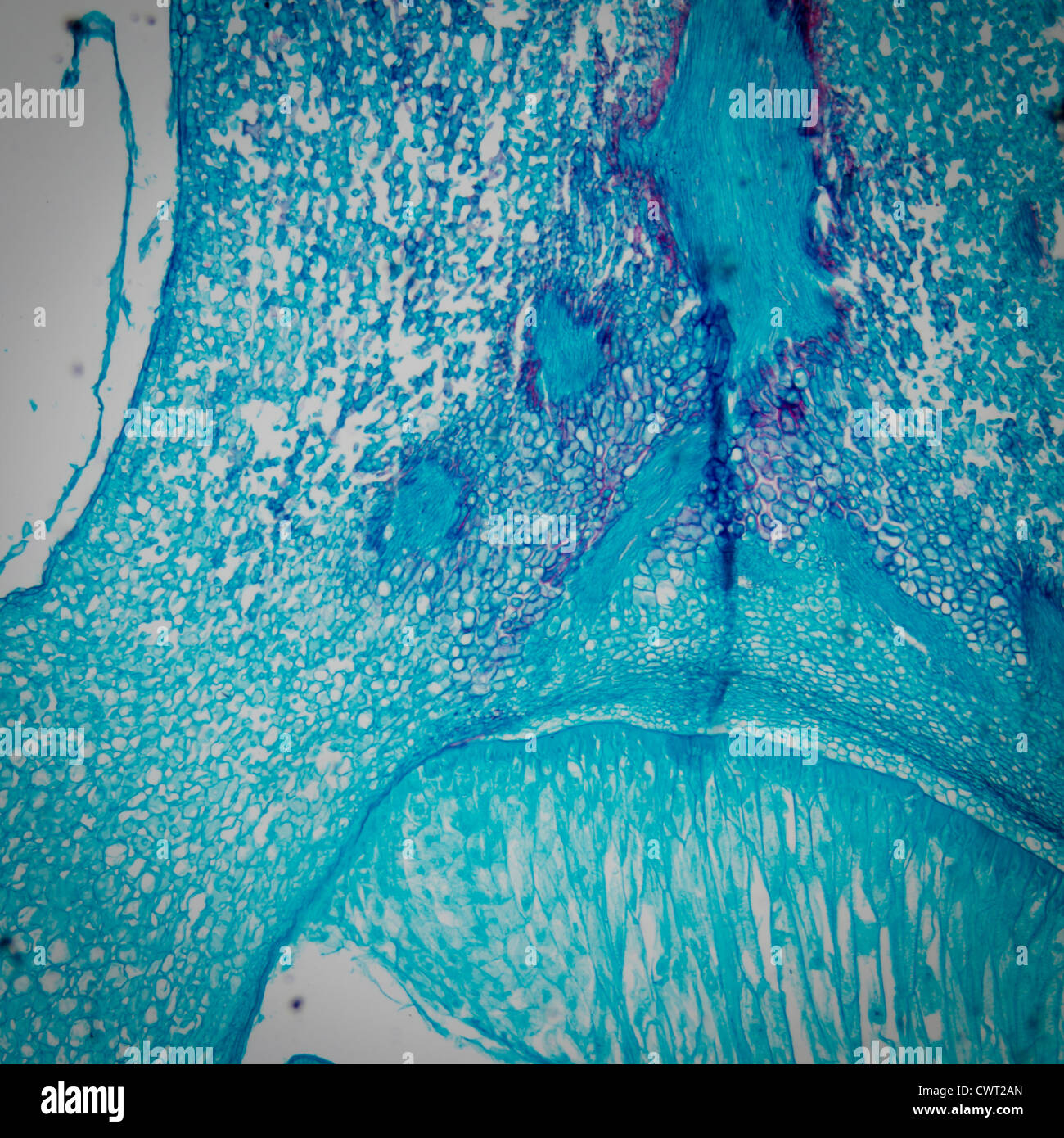 microscopy micrograph plant tissue, corn embryo Stock Photo - Alamy