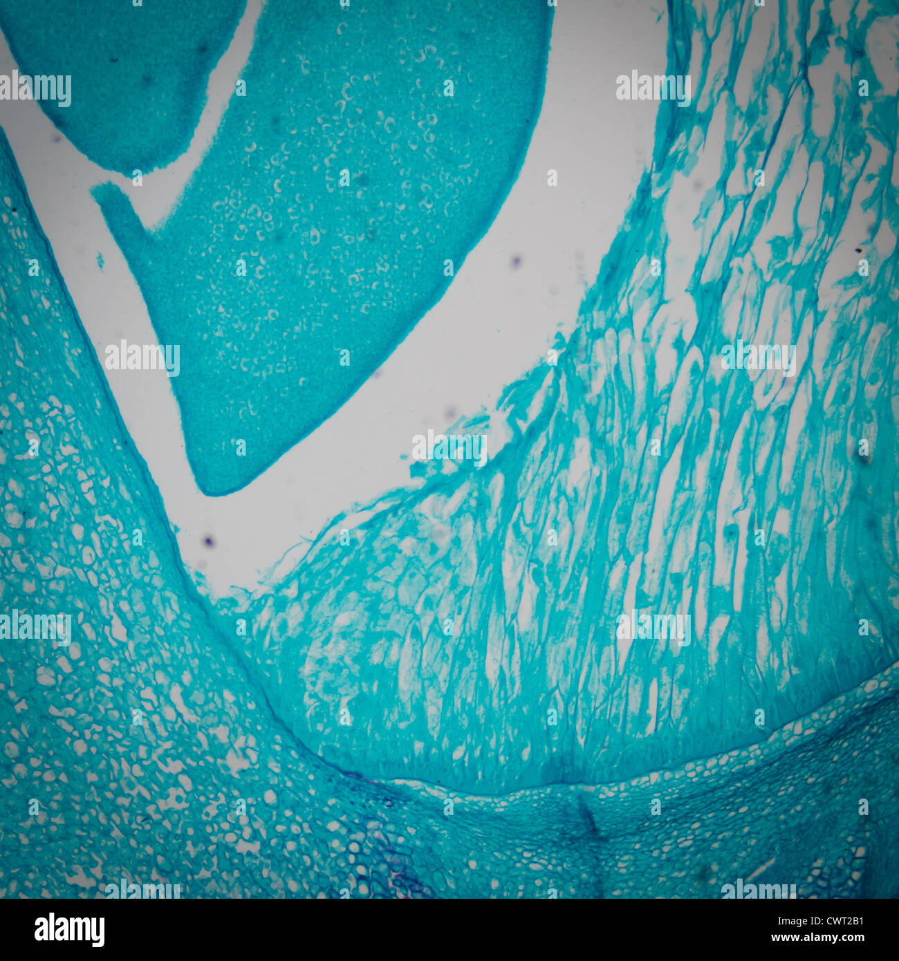 microscopy micrograph plant tissue, corn embryo Stock Photo - Alamy