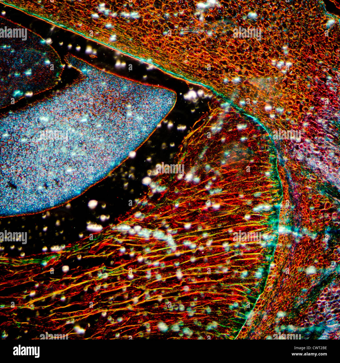 Corn grain micrograph hi-res stock photography and images - Alamy