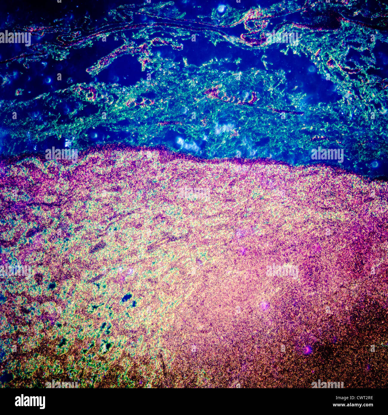 Lymph node micrograph hi-res stock photography and images - Alamy