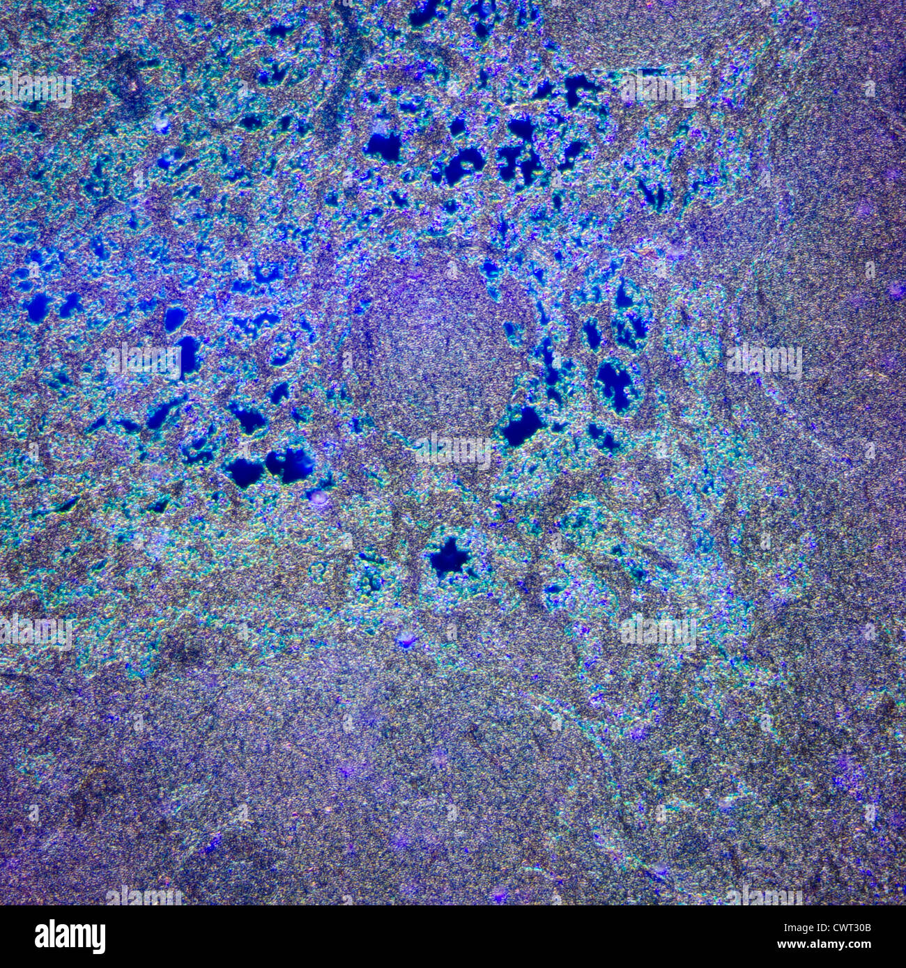 Lymphatic vessel microscope hi-res stock photography and images - Alamy