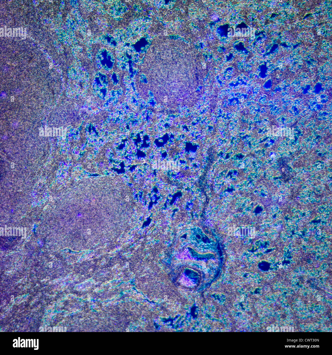 science medical anthropotomy physiology microscopic section of lymph ...