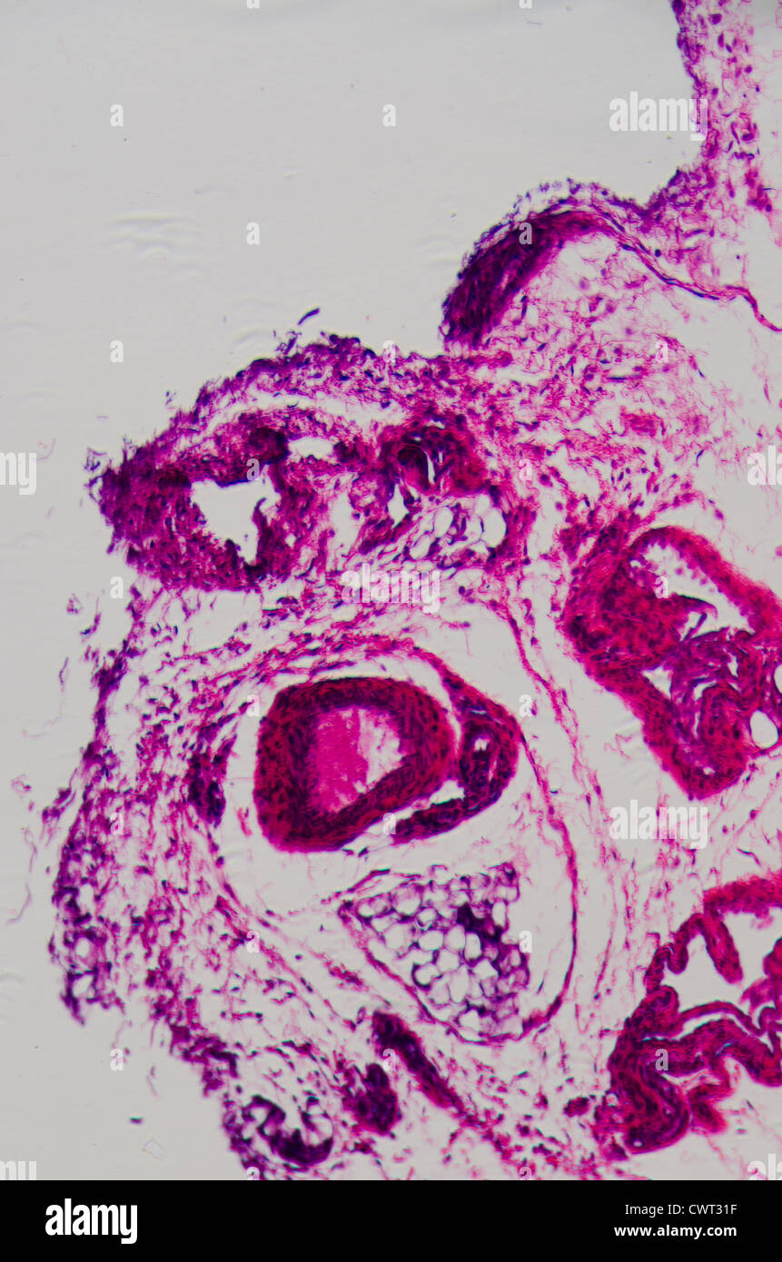 Lymphatic vessel microscope hi-res stock photography and images - Alamy