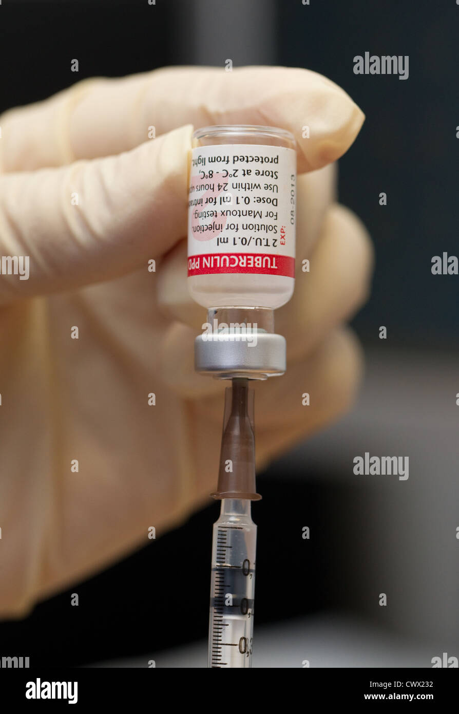 Mantoux hi-res stock photography and images - Alamy
