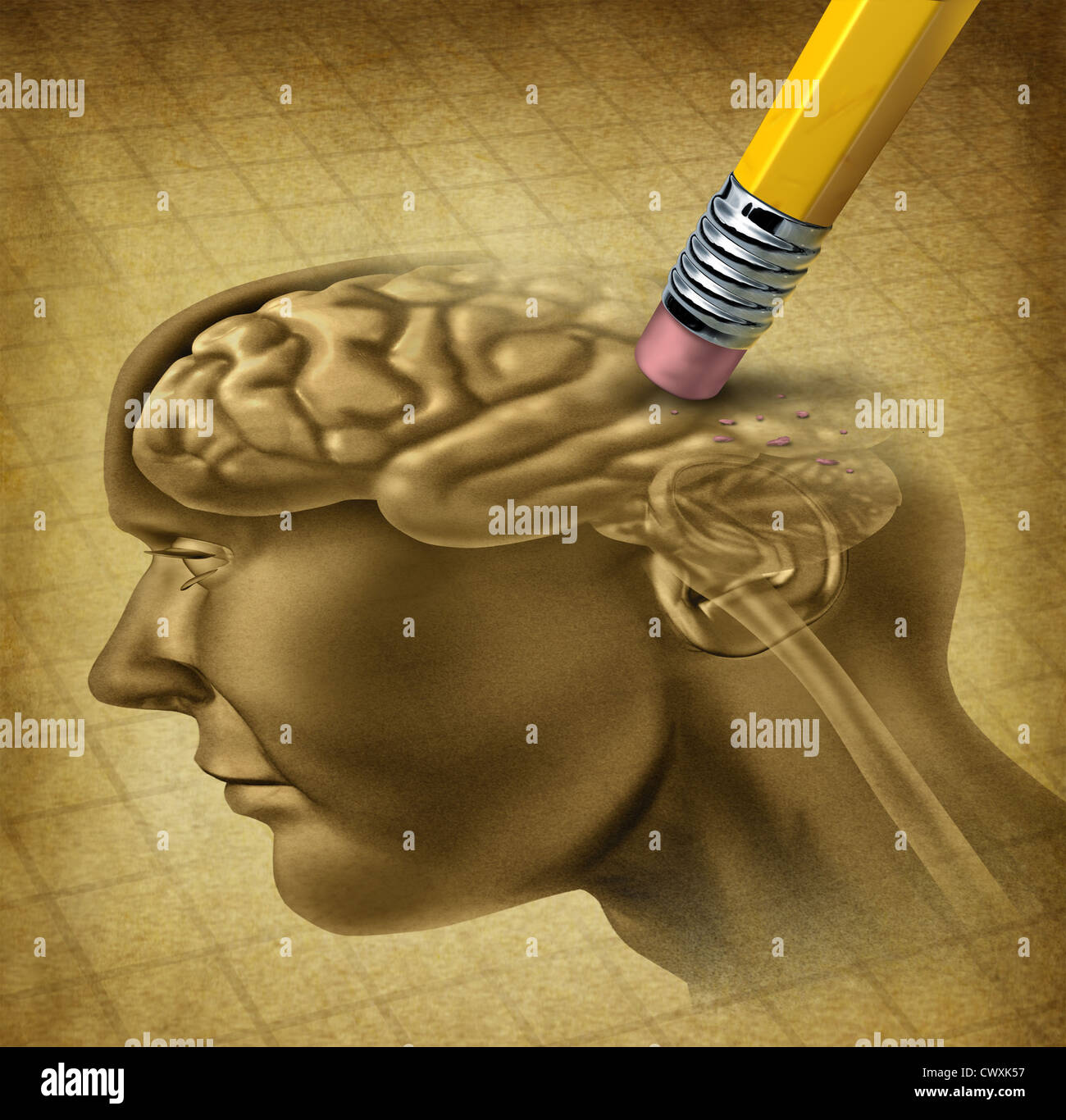 Dementia disease and a loss of brain function and losing memories as ...