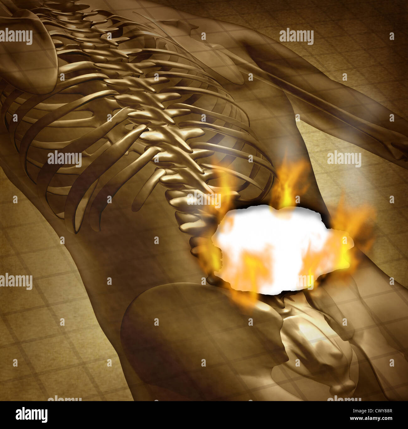Human burning back pain and backache medical concept with a grunge old ...