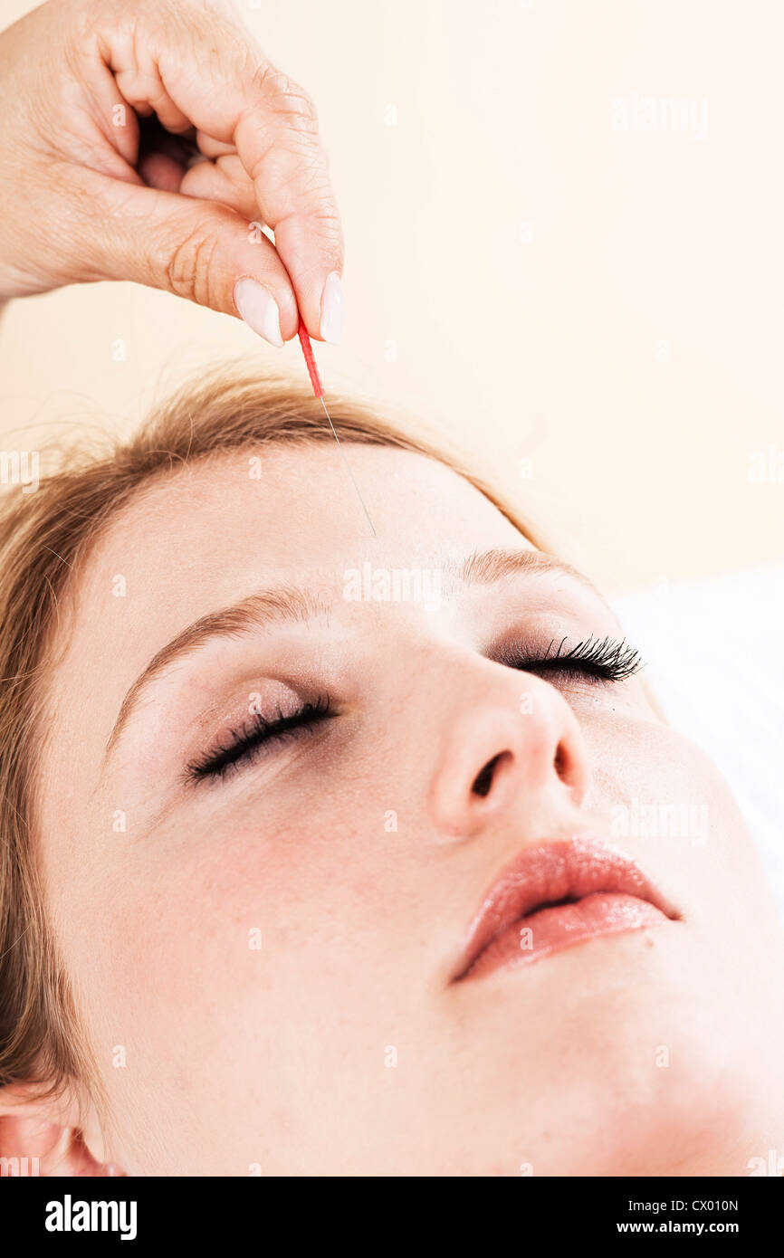 Woman getting acupuncture needle Stock Photo - Alamy