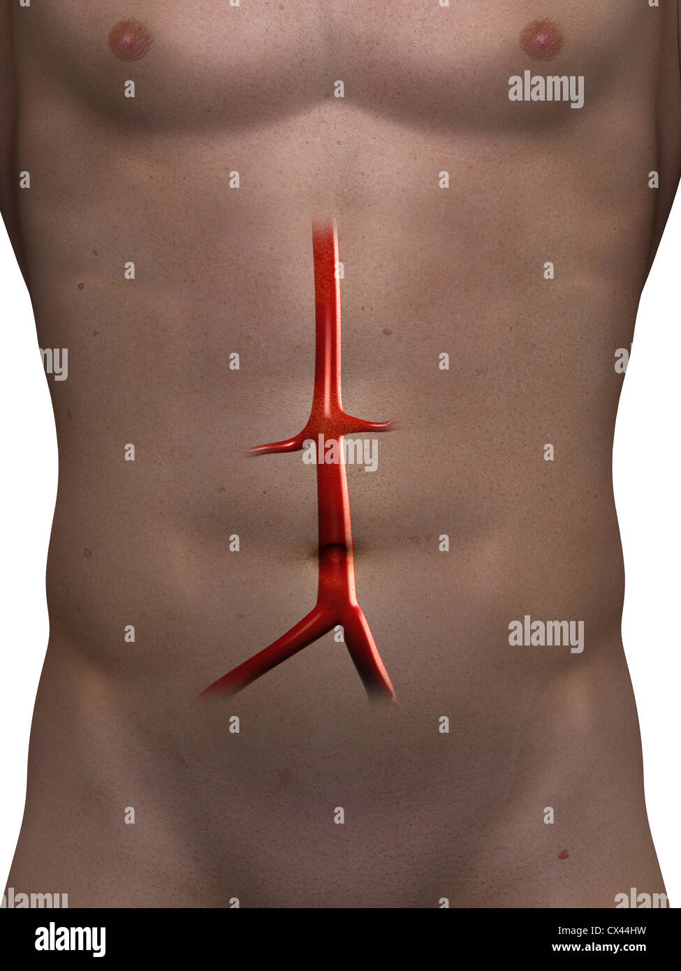 Abdominal hi-res stock photography and images - Alamy