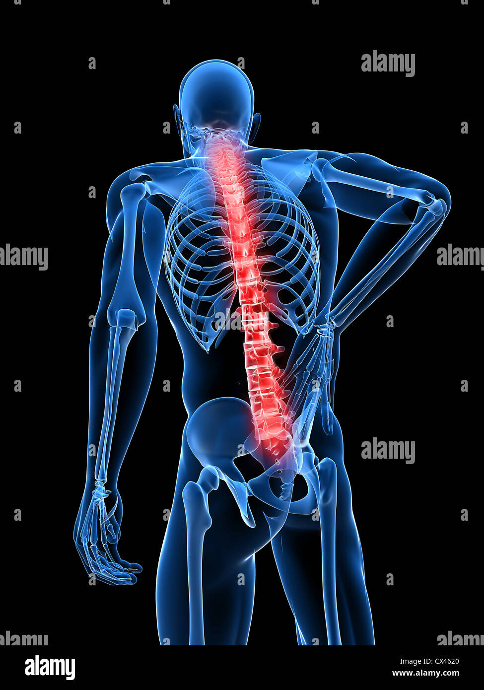 Posture spine xray hi-res stock photography and images - Alamy
