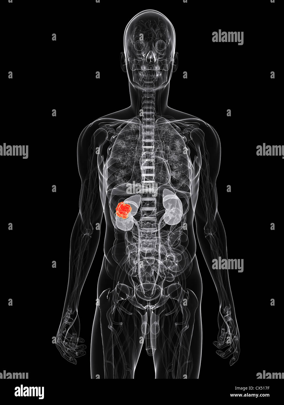 Kidneys disease hi-res stock photography and images - Alamy