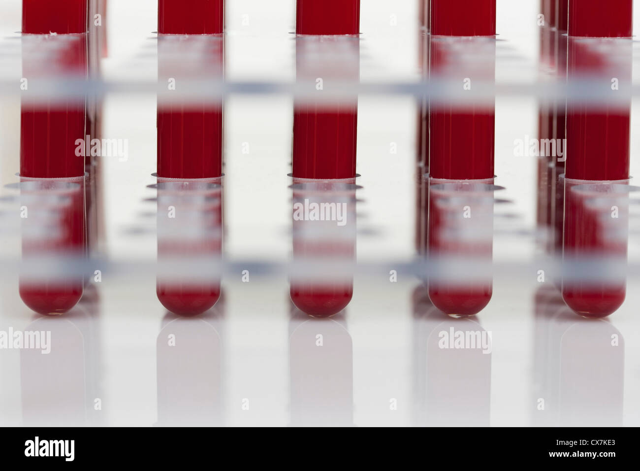 Blood sample tube shelf hi-res stock photography and images - Alamy