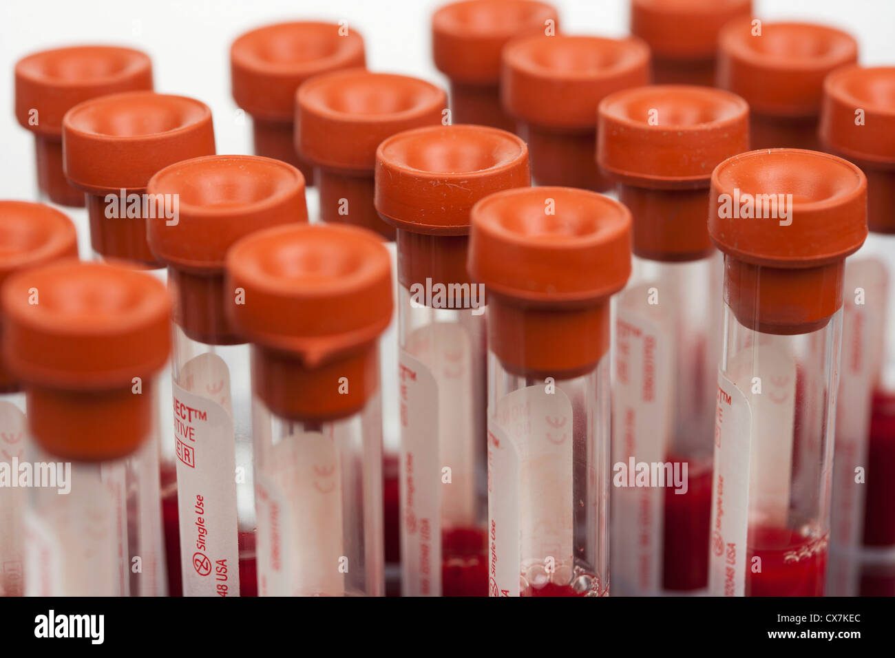 Blood test tubes order hi-res stock photography and images - Alamy