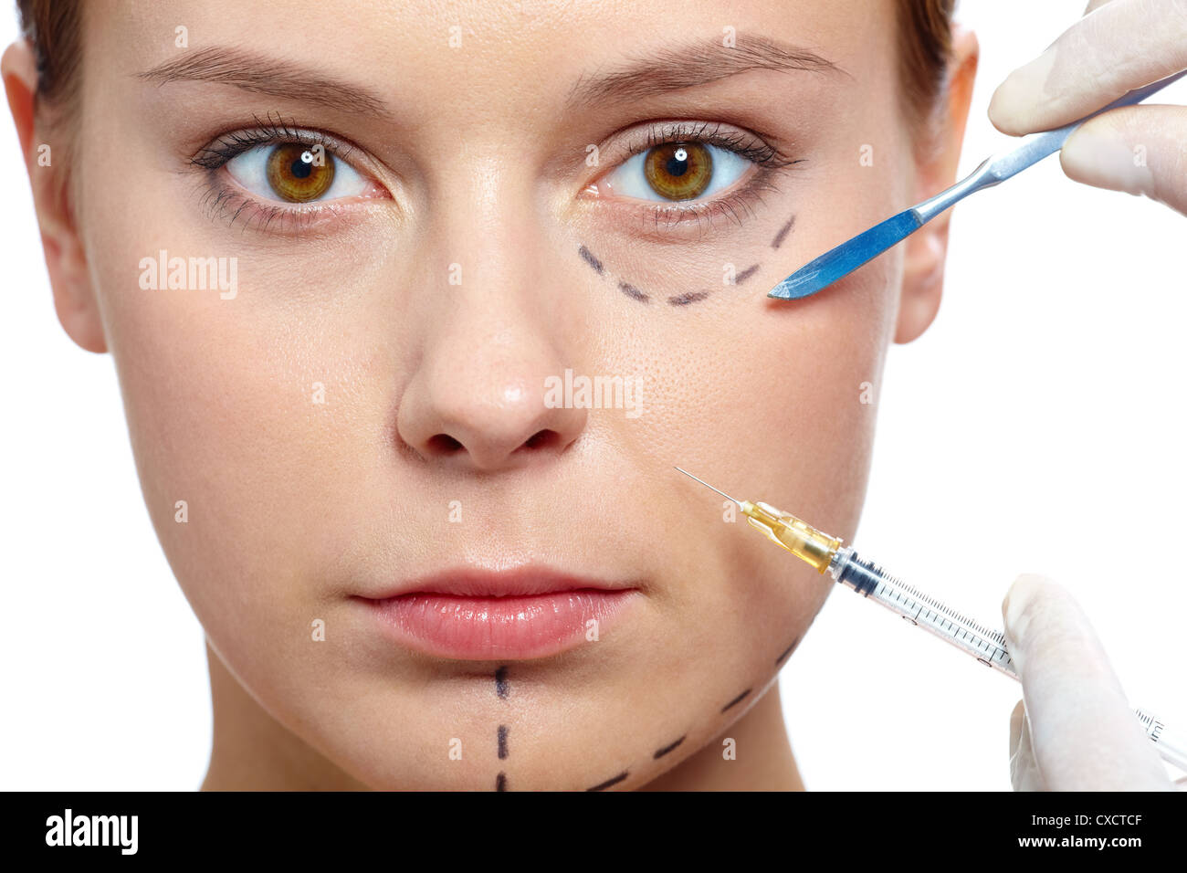 Fresh woman with marks drawn on face during botox procedure Stock Photo ...