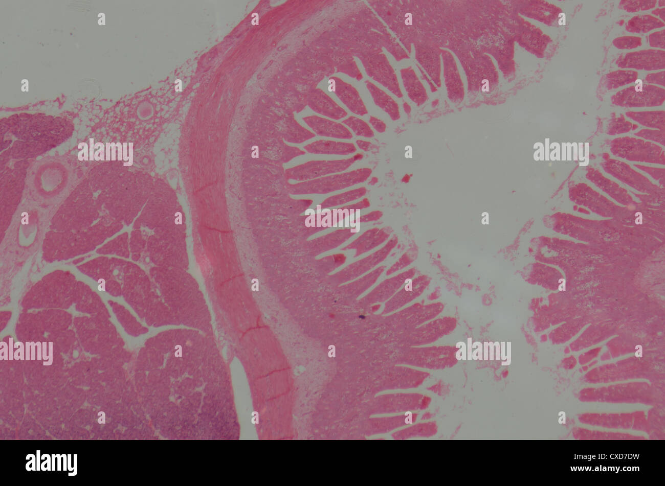 microscopic section of human small intestinum tenue tissue Stock Photo ...