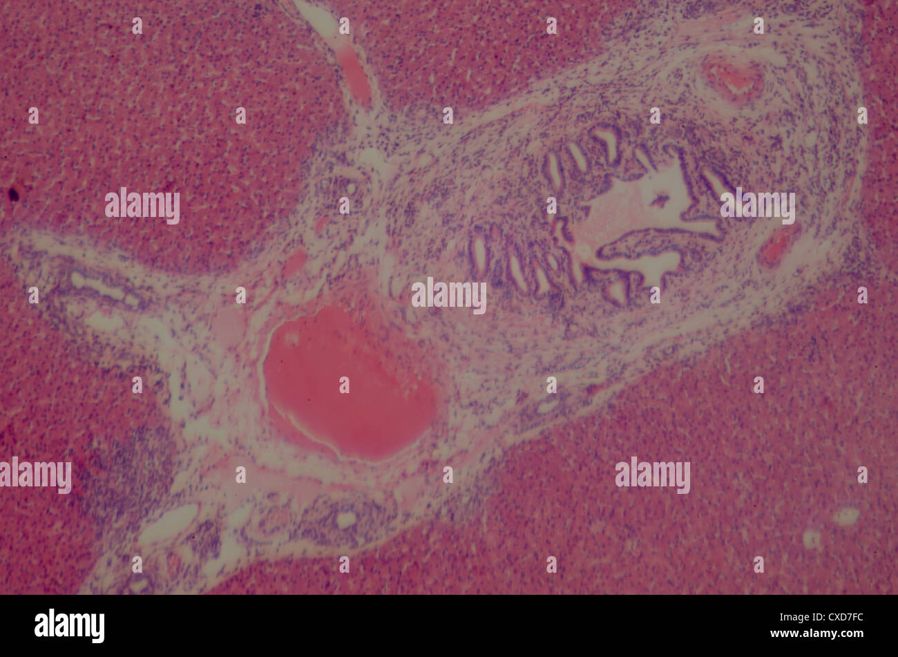 microscopic section of human liver Stock Photo - Alamy