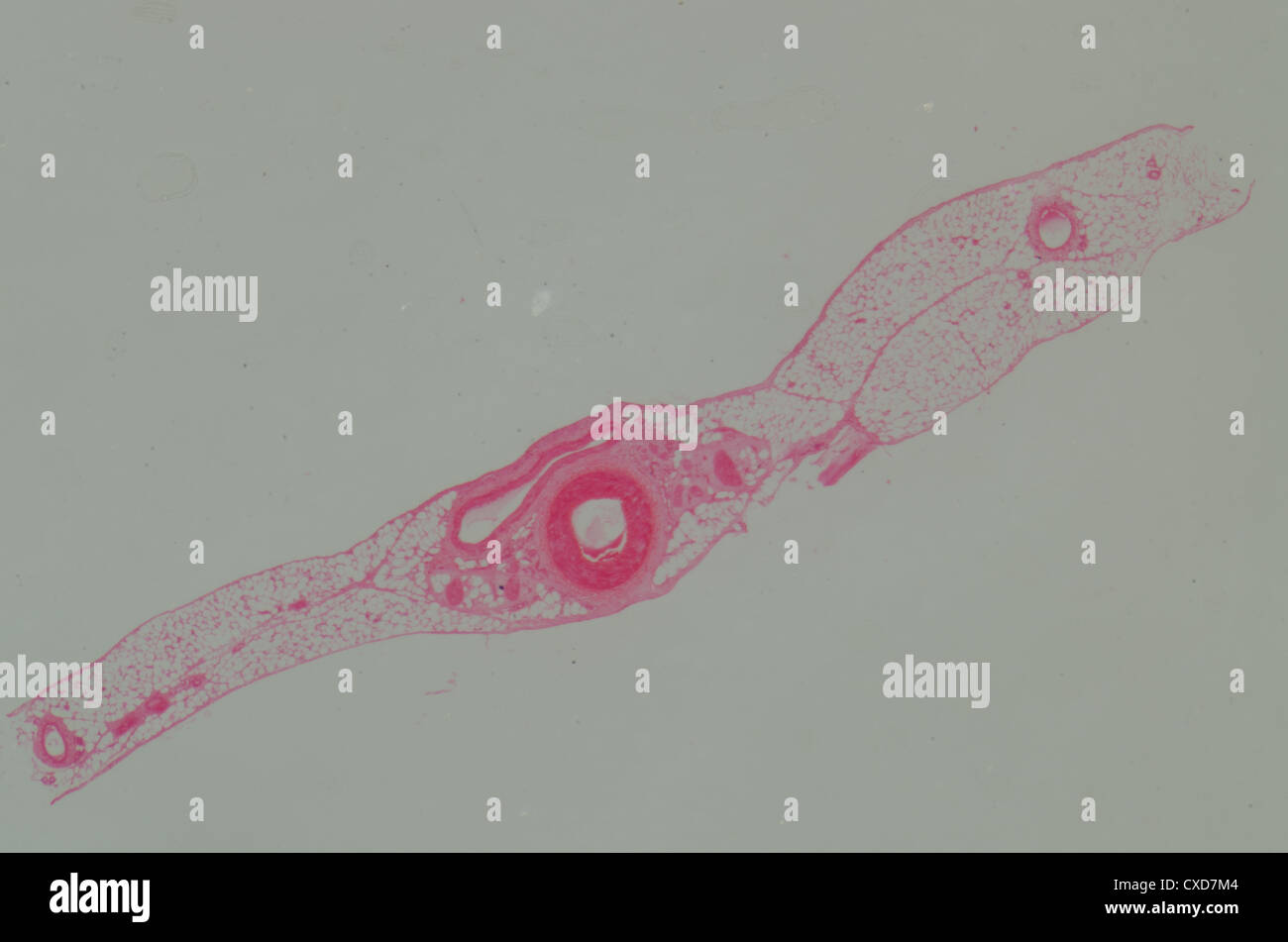 microscopic section of human artery vein Stock Photo - Alamy