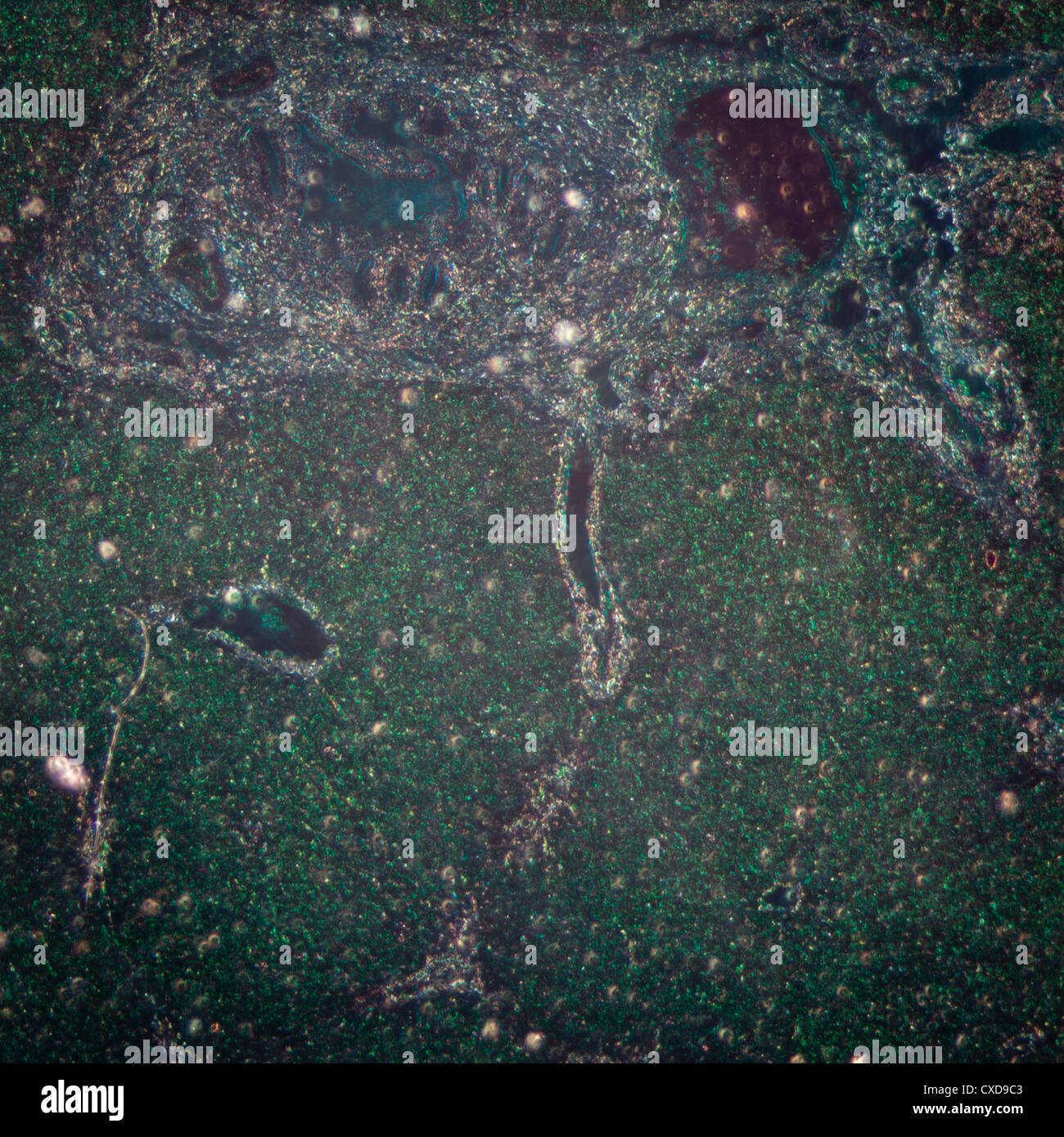 Human skin cells micrograph hi-res stock photography and images - Alamy