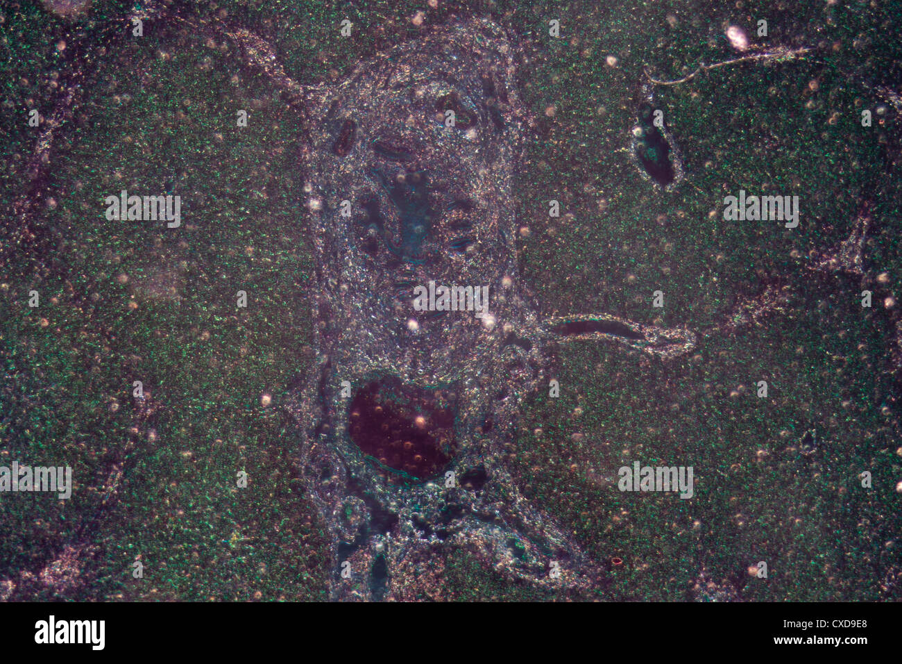 micrograph of liver tissue Stock Photo - Alamy