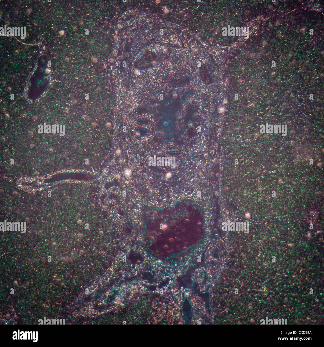 micrograph of liver tissue Stock Photo - Alamy