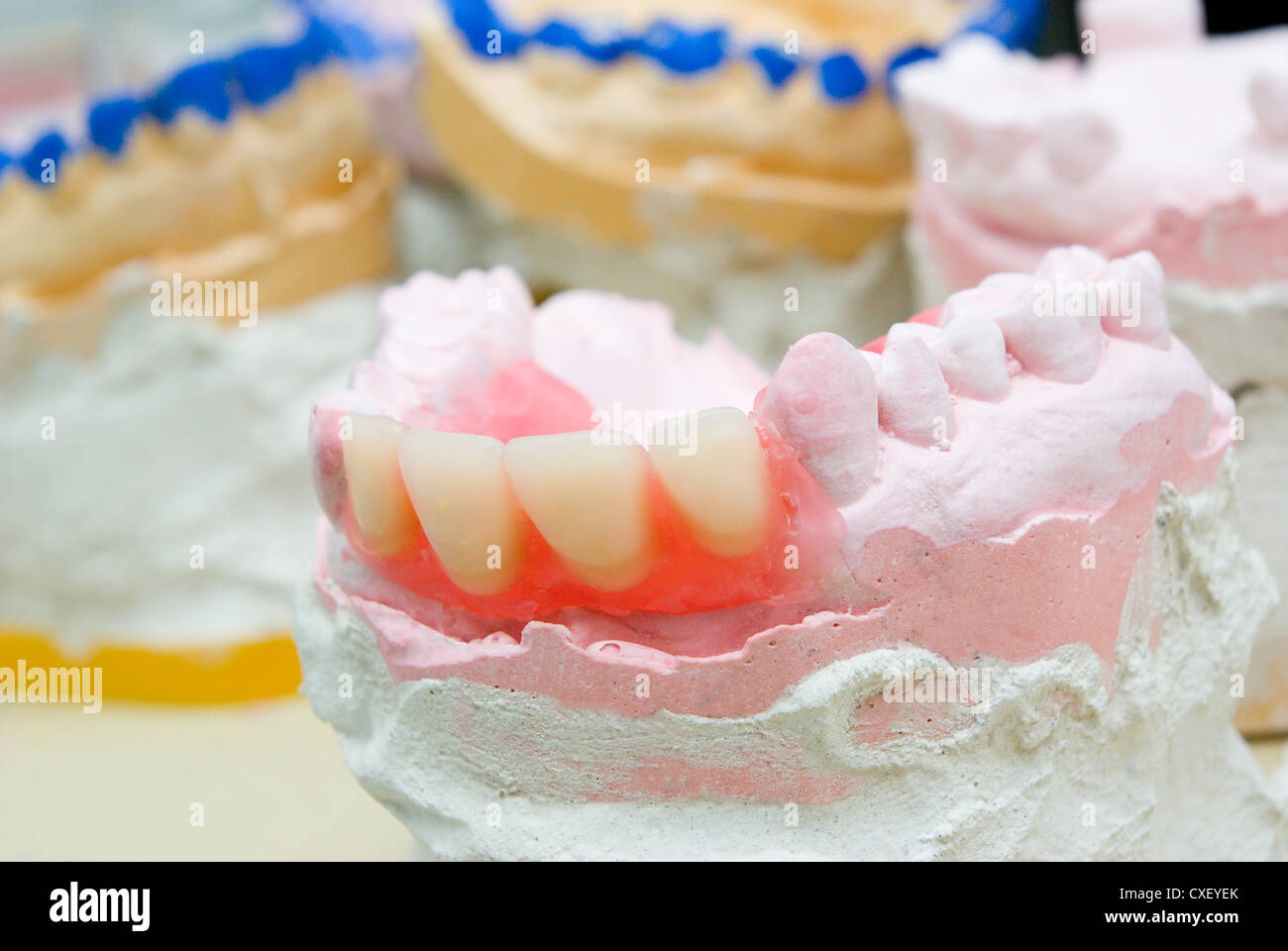 teeth mold and prosthetic devices close-up Stock Photo - Alamy