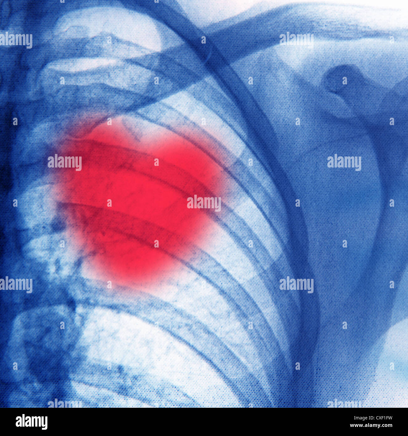 Chest radiation hi-res stock photography and images - Alamy