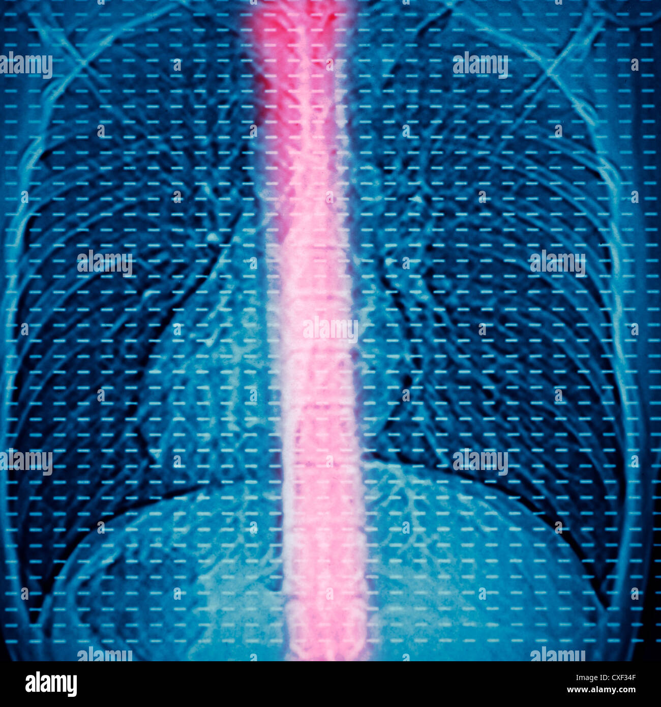 human lumbar bone Stock Photo - Alamy