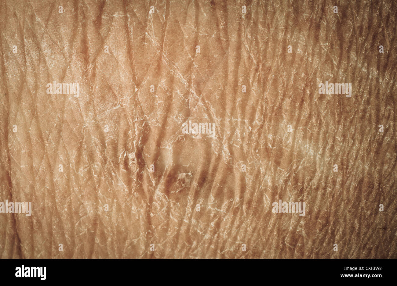 dry skin texture Stock Photo - Alamy