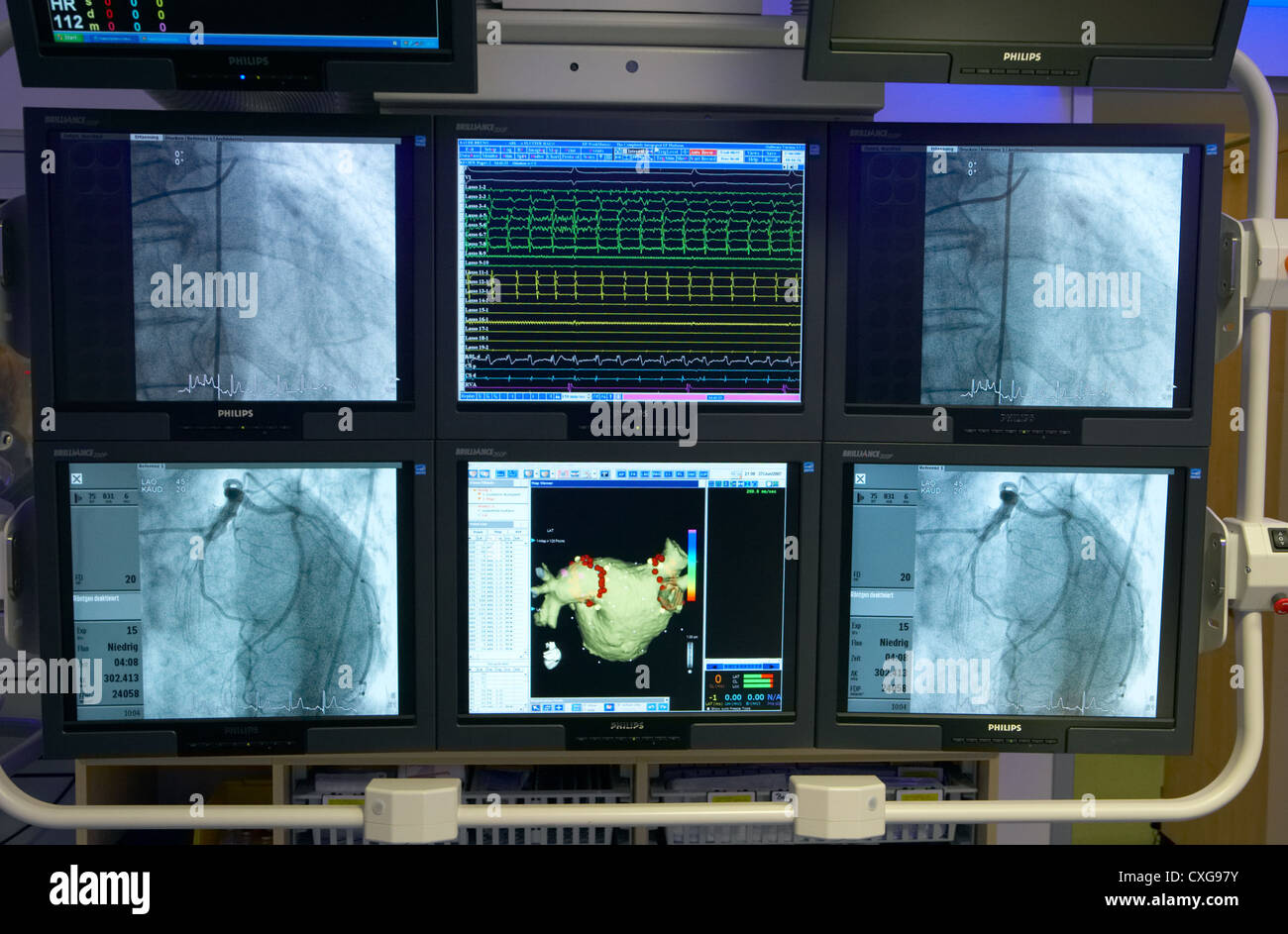 Cath lab hi-res stock photography and images - Alamy