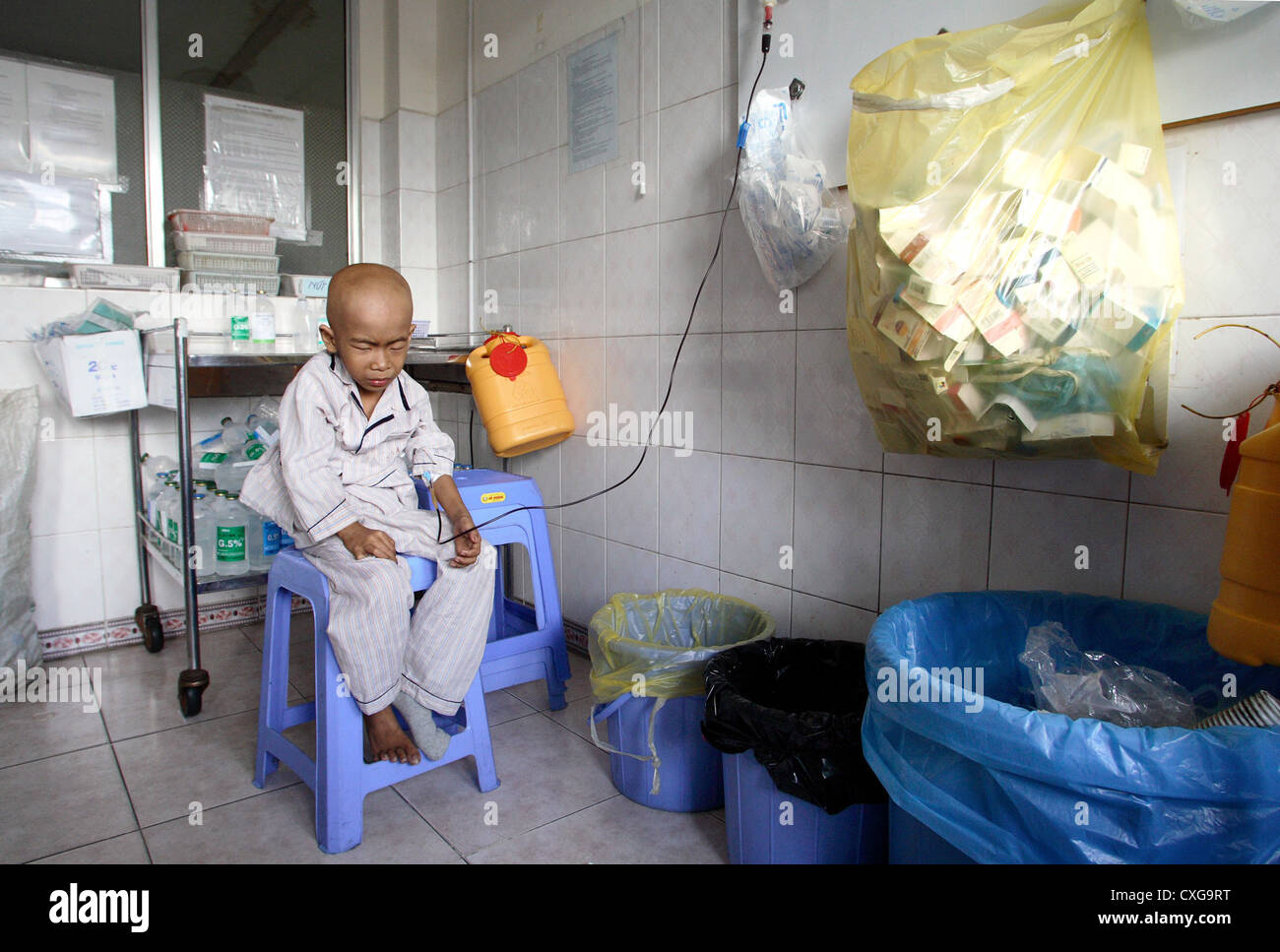 Crying child with chemotherapy on a cancer ward in Saigon Stock Photo ...