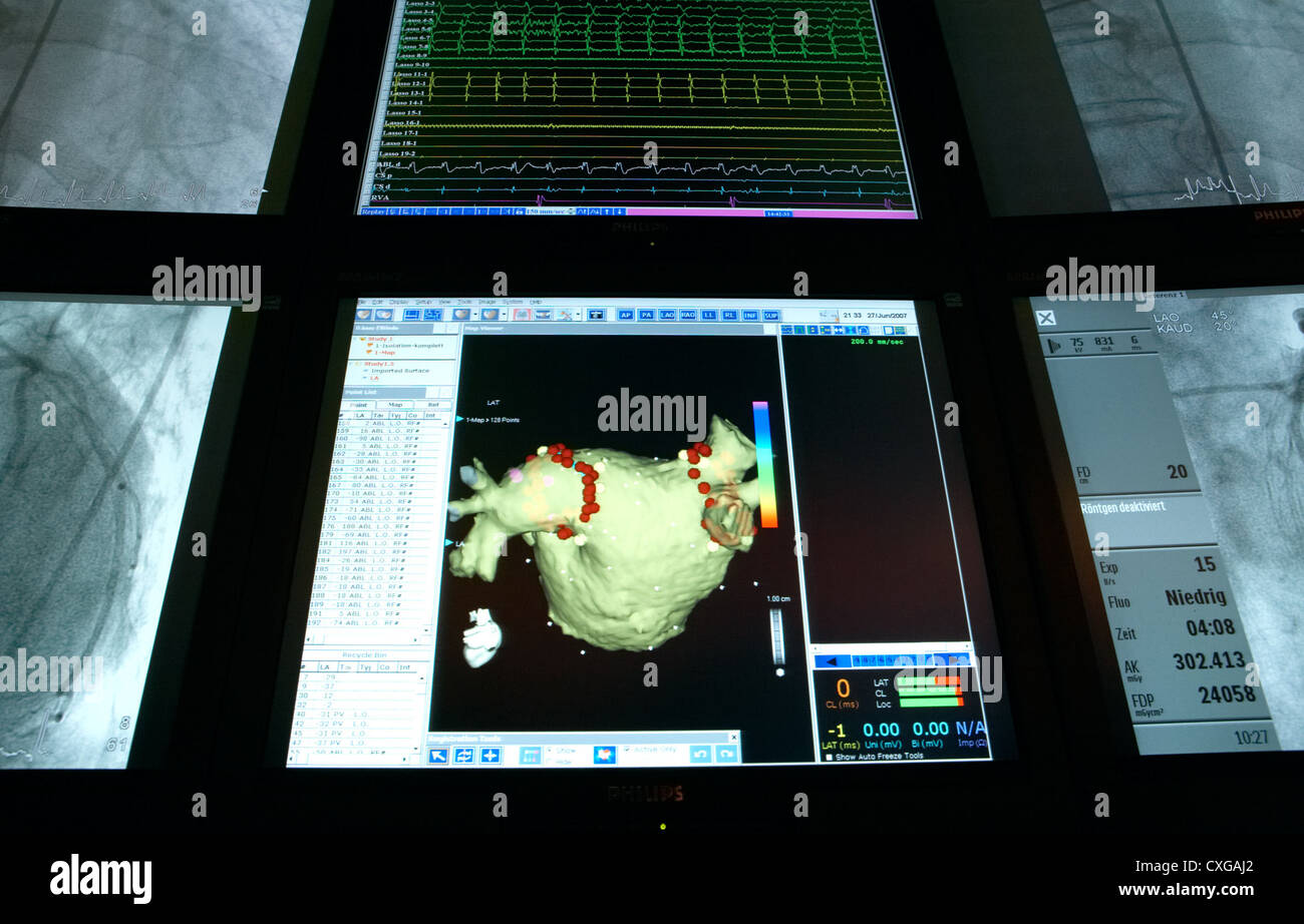 Berlin, monitors in a highly modern cardiology clinic Stock Photo - Alamy