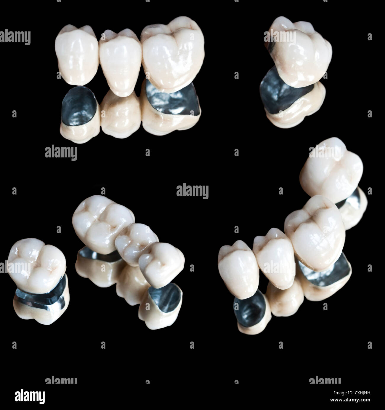 Ceramic teeth hi-res stock photography and images - Alamy