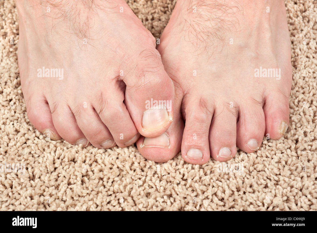 A man with itchy feet uses his big toe to scratch his other foot. Good ...