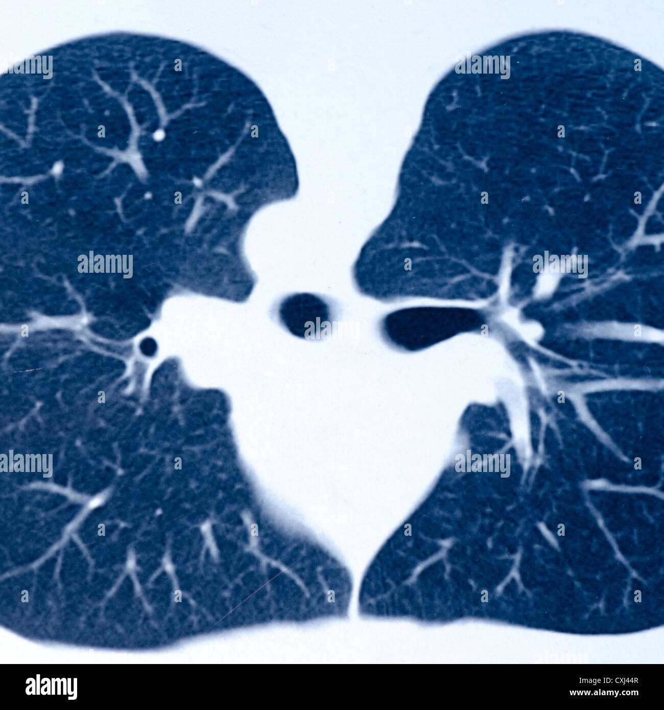 human lumbar bone Stock Photo - Alamy