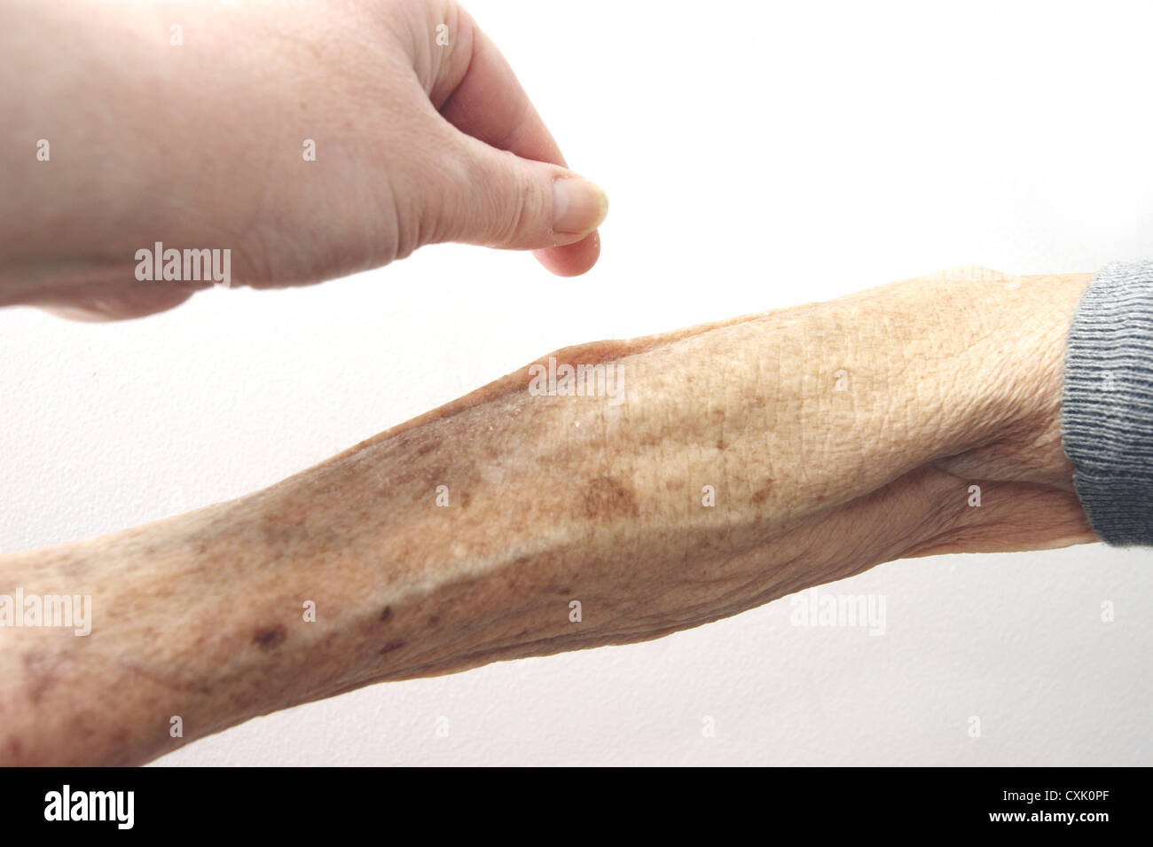 Illustrate a skin turgor hi-res stock photography and images - Alamy